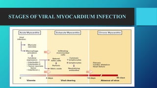 MYOCARDITIS | PDF | Heart and Cardiovascular Diseases | Diseases and ...