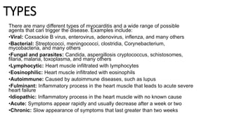 Myocarditis | PPT