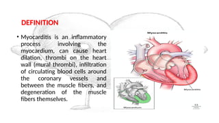 Myocarditis - short ppt for nursing students | PPTX