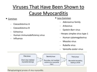 Myocarditis by Shipra Shekhar | PPT
