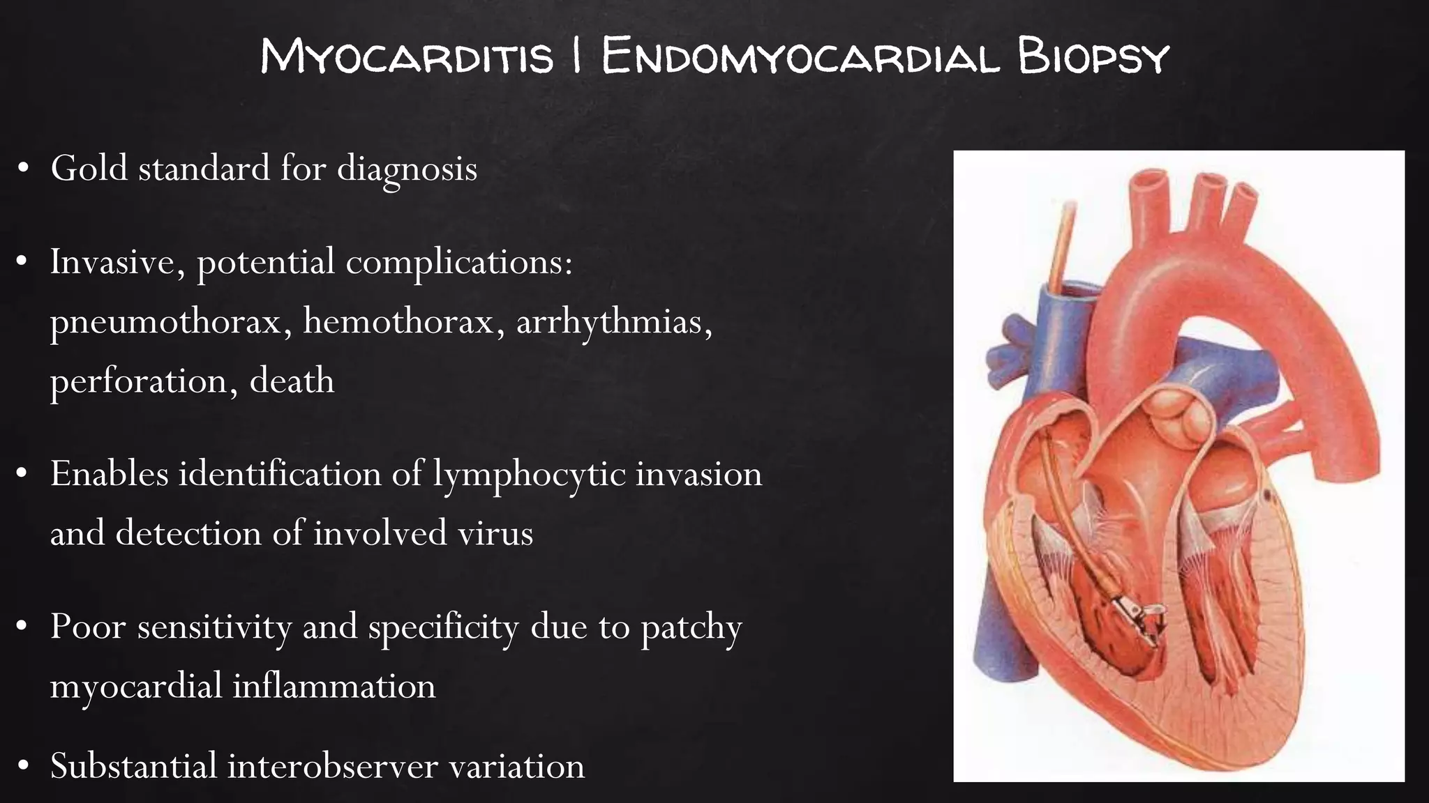 Myocarditis pediatrics ppt | PPTX