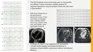 Myocarditis & pericarditis | PPTX