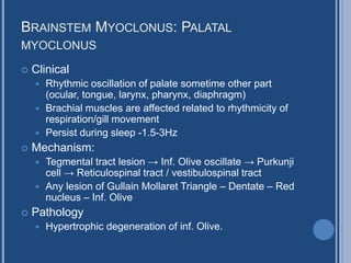 Myoclonus | PPTX