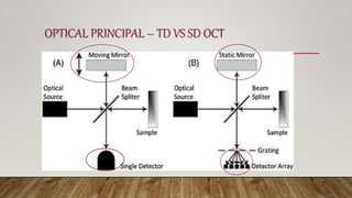 Glaucoma oct (optical coherence tomography) | PPTX