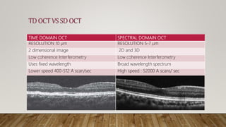Glaucoma oct (optical coherence tomography) | PPTX
