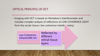 Glaucoma oct (optical coherence tomography) | PPTX