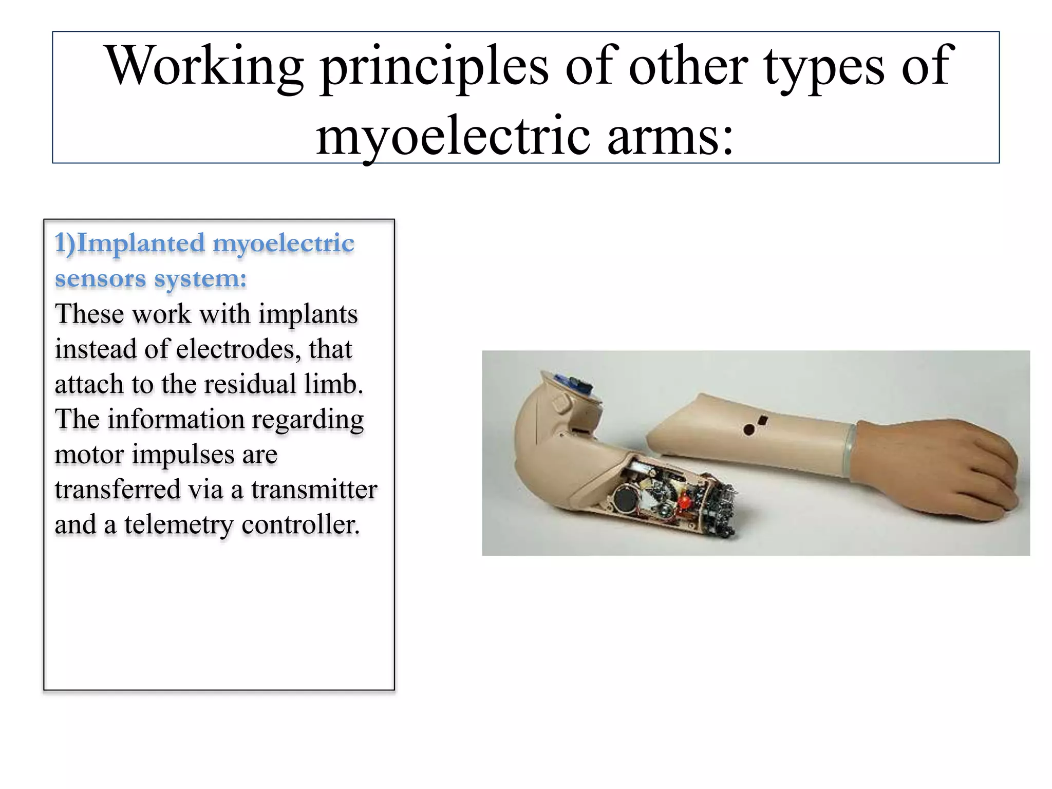 Myoelectric prosthesis | PPTX