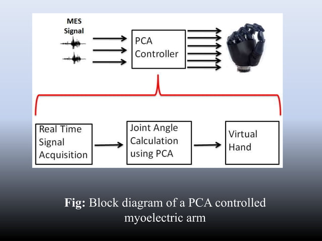 Myoelectric prosthesis | PPTX