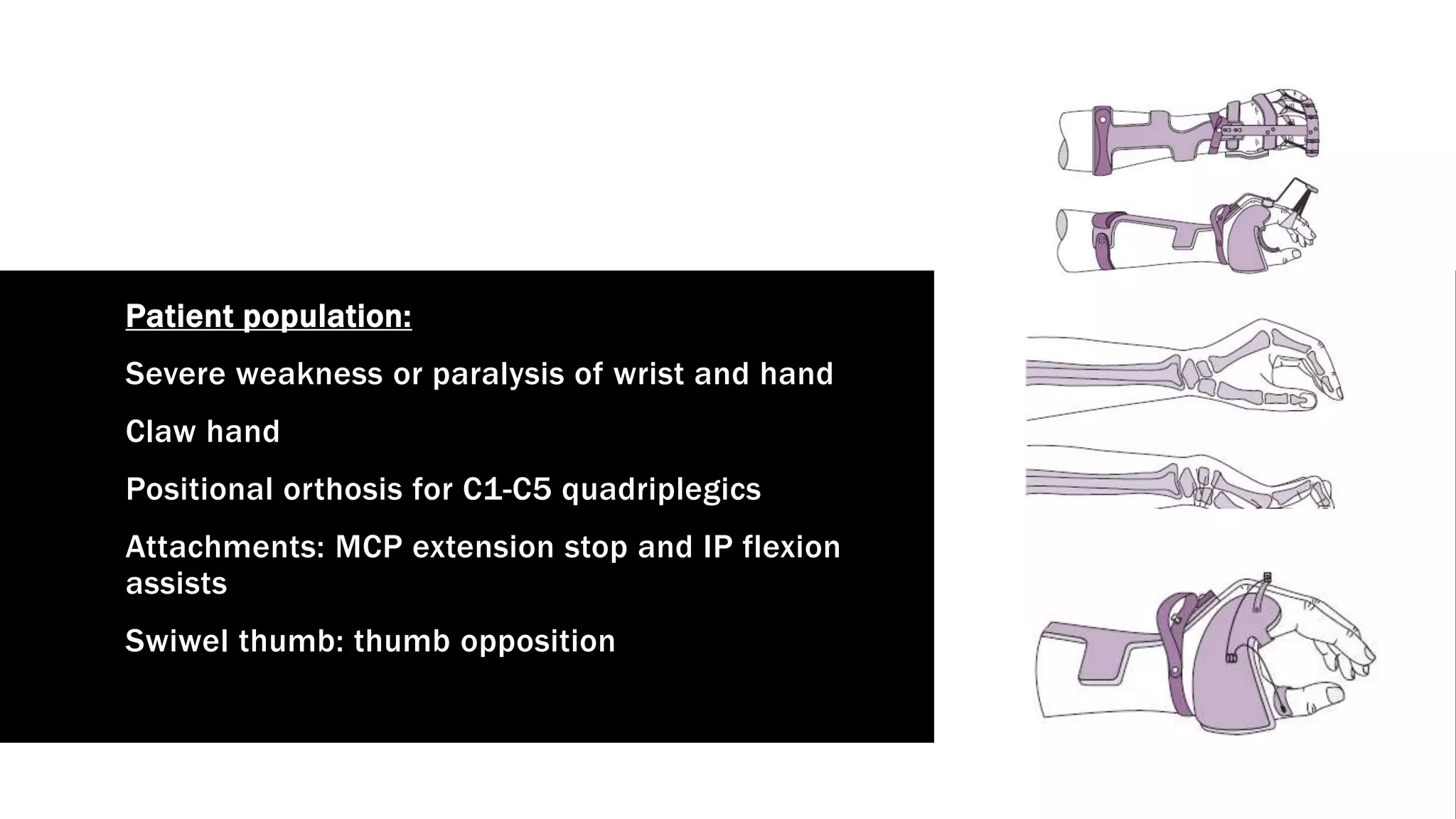 orthosis and prosthesis of upper limb | PPTX