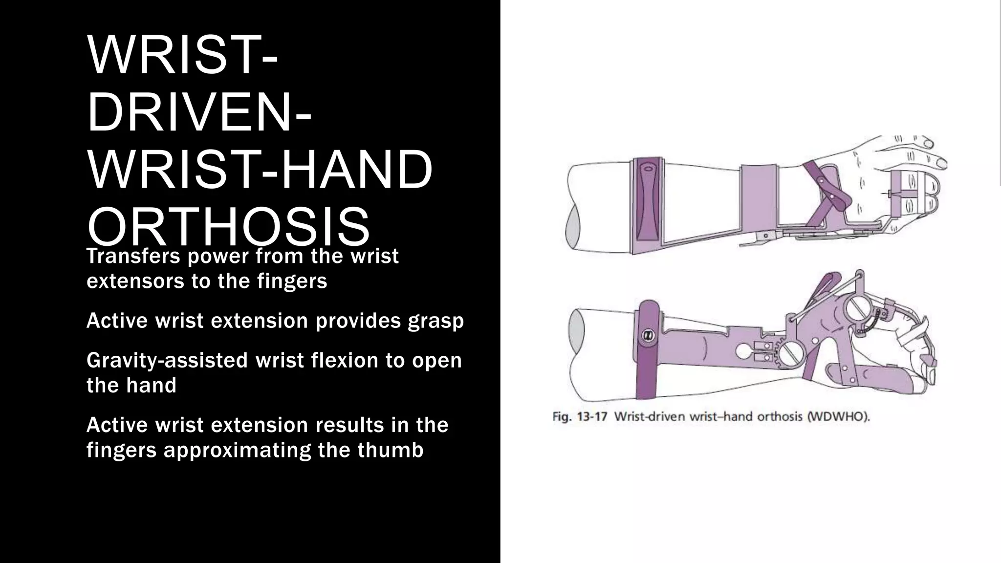 orthosis and prosthesis of upper limb | PPTX