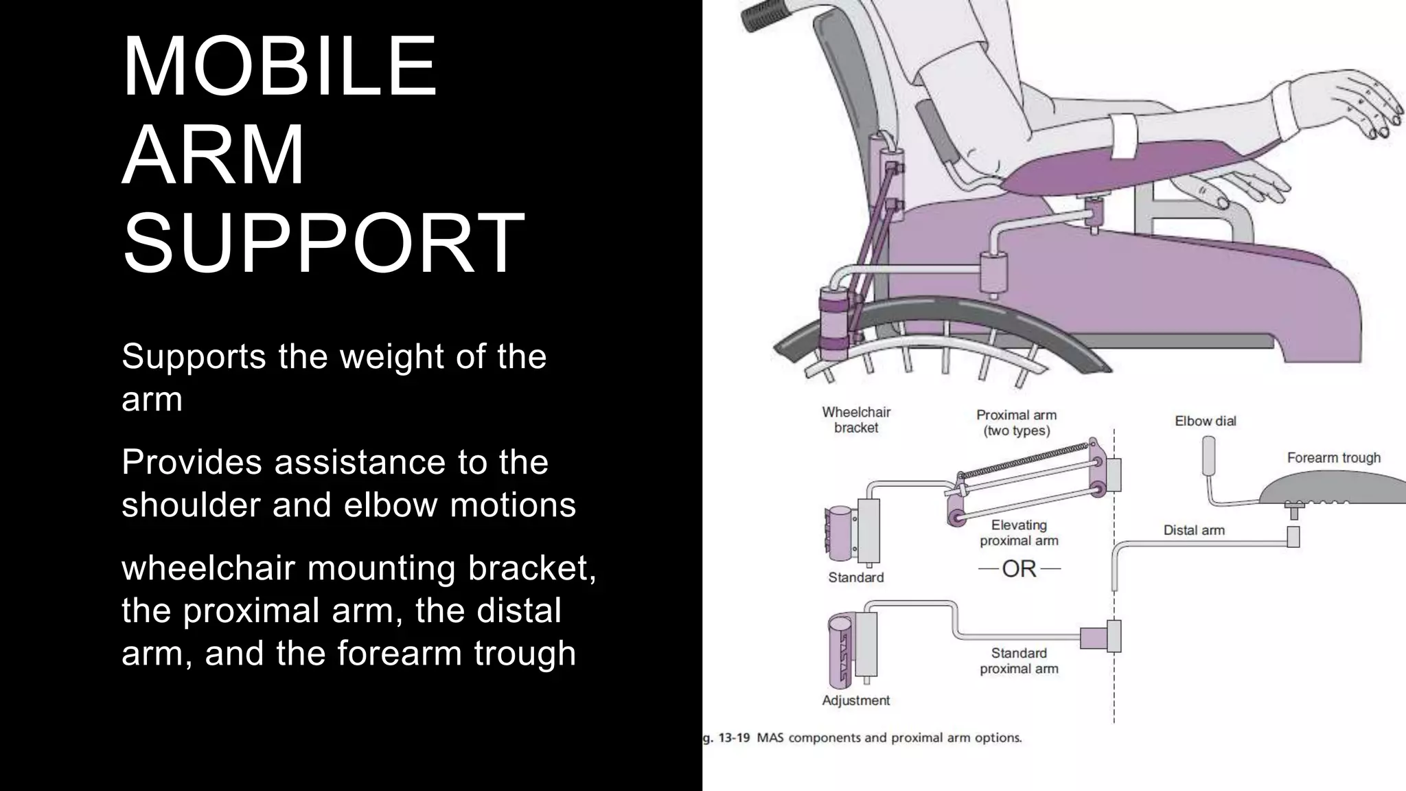 orthosis and prosthesis of upper limb | PPTX