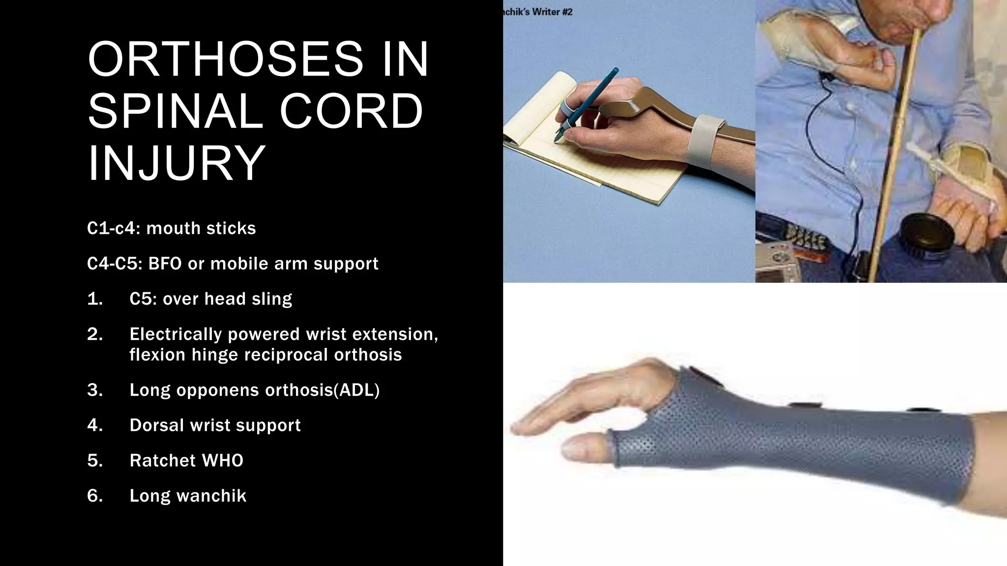 orthosis and prosthesis of upper limb | PPTX