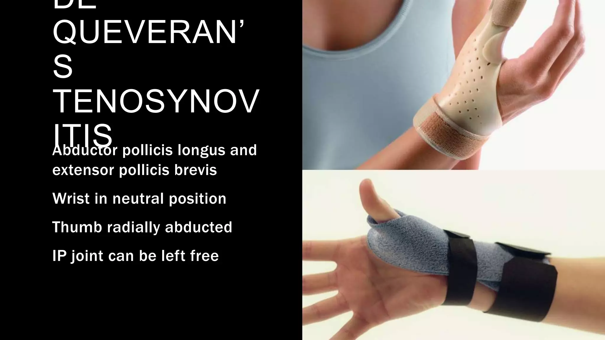 orthosis and prosthesis of upper limb | PPTX