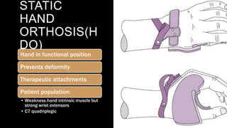 orthosis and prosthesis of upper limb | PPTX