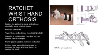orthosis and prosthesis of upper limb | PPTX
