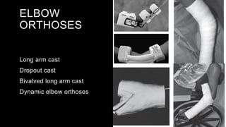 orthosis and prosthesis of upper limb | PPTX