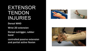 orthosis and prosthesis of upper limb | PPTX