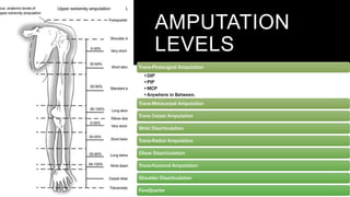orthosis and prosthesis of upper limb | PPTX