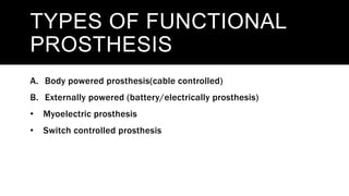 orthosis and prosthesis of upper limb | PPTX