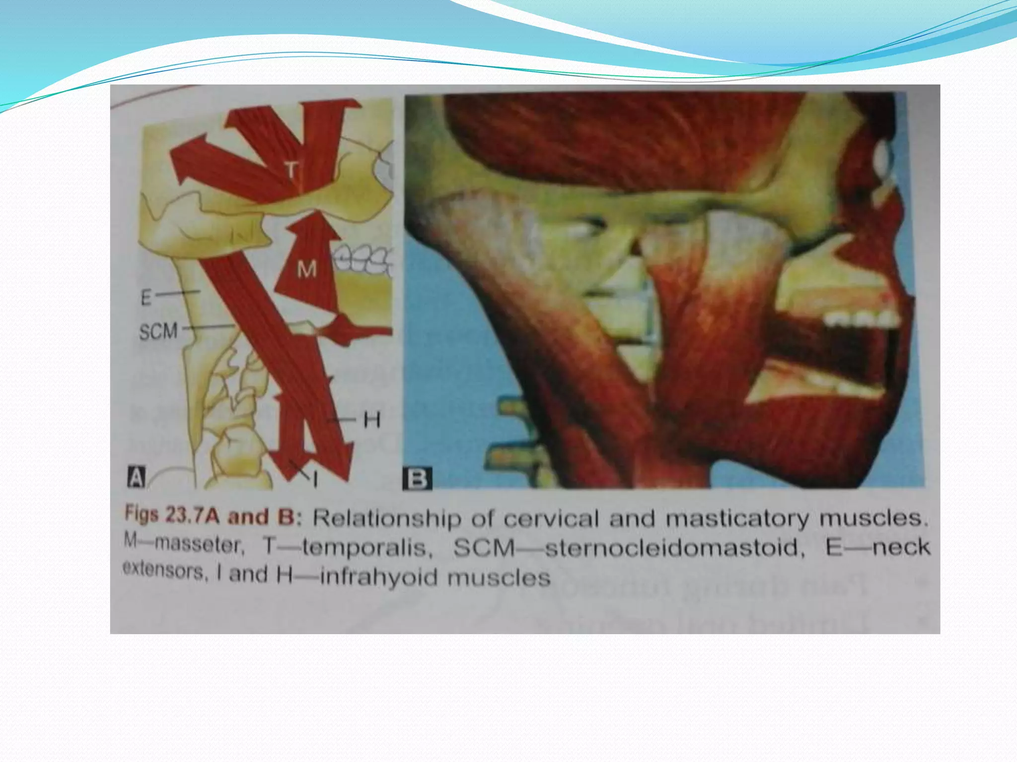 MYOFACIAL PAIN DYSFUNCTION SYNDROME.pptx