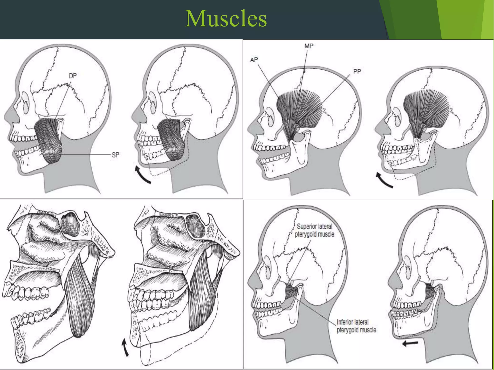 Myofacial pain dysfunction syndrome anindya | PPTX