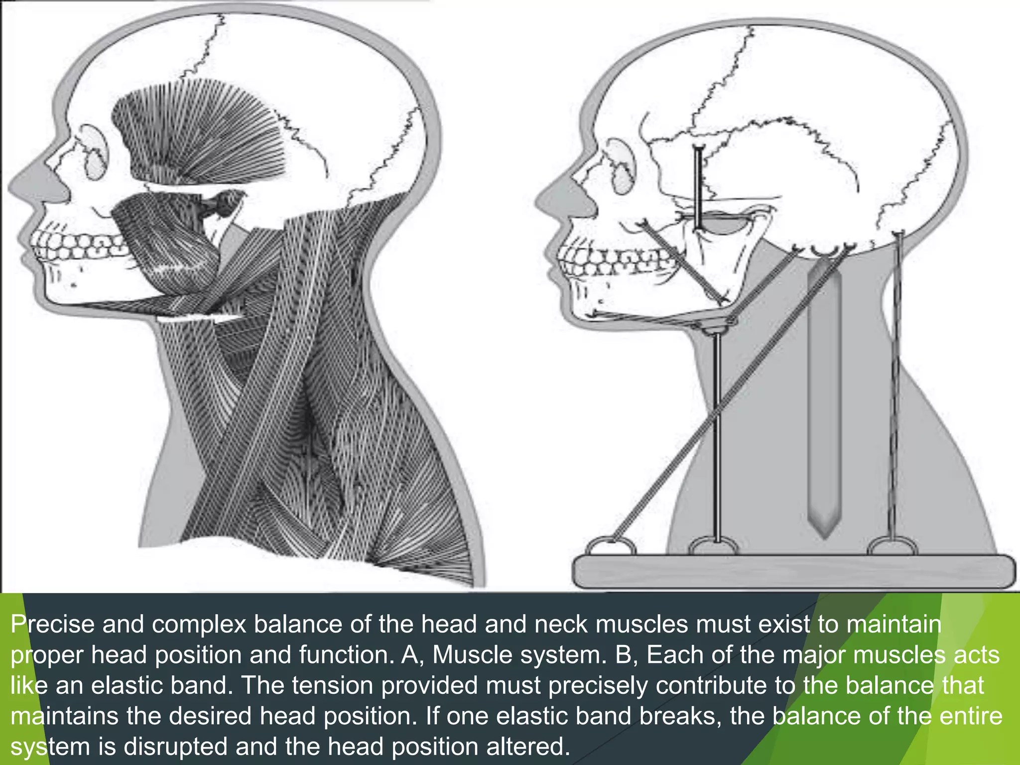 Myofacial pain dysfunction syndrome anindya | PPTX