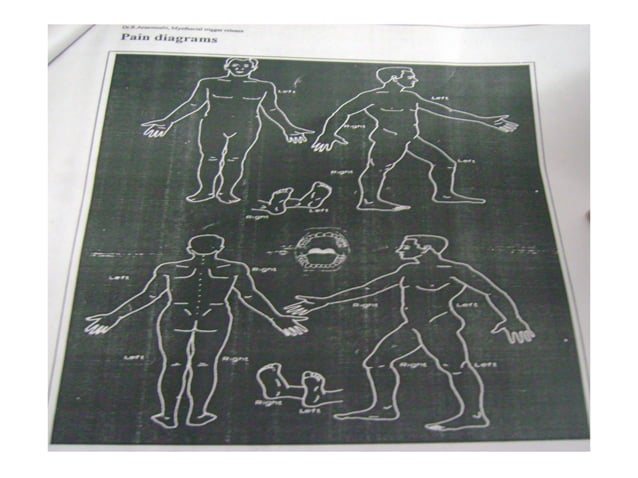 Myofacial Release Therapy(MFR). | PPT | Death, Injury, or Military ...