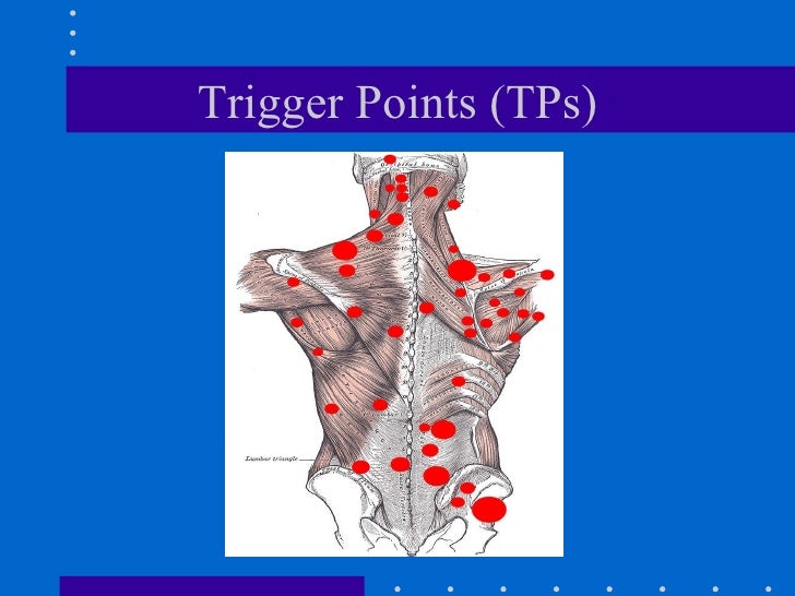 Myofascial pain syndrome