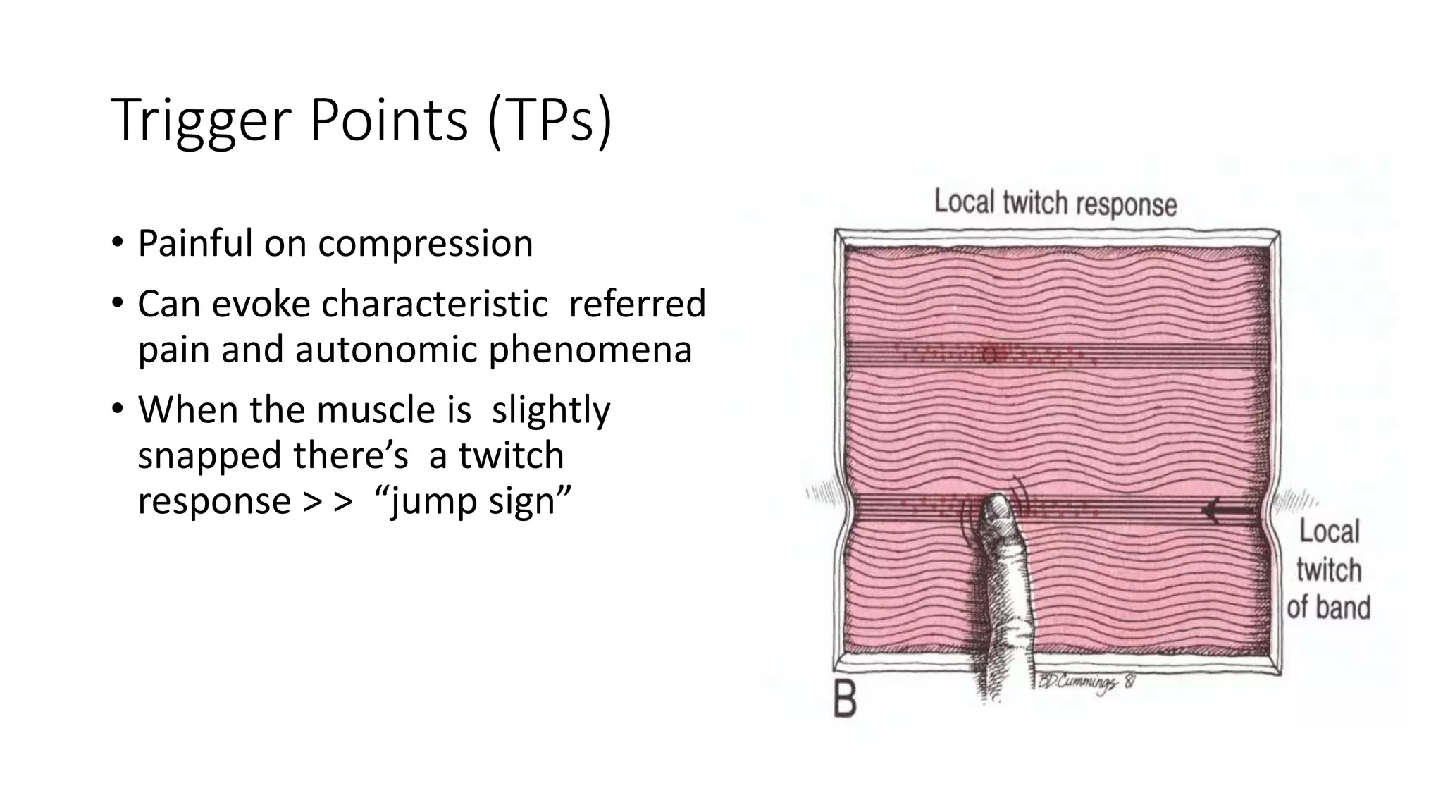 Myofascial Pain.pptx