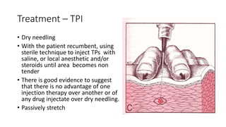 Myofascial Pain.pptx