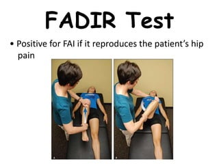 Myofascial pain conditions causing low back pain | PPT