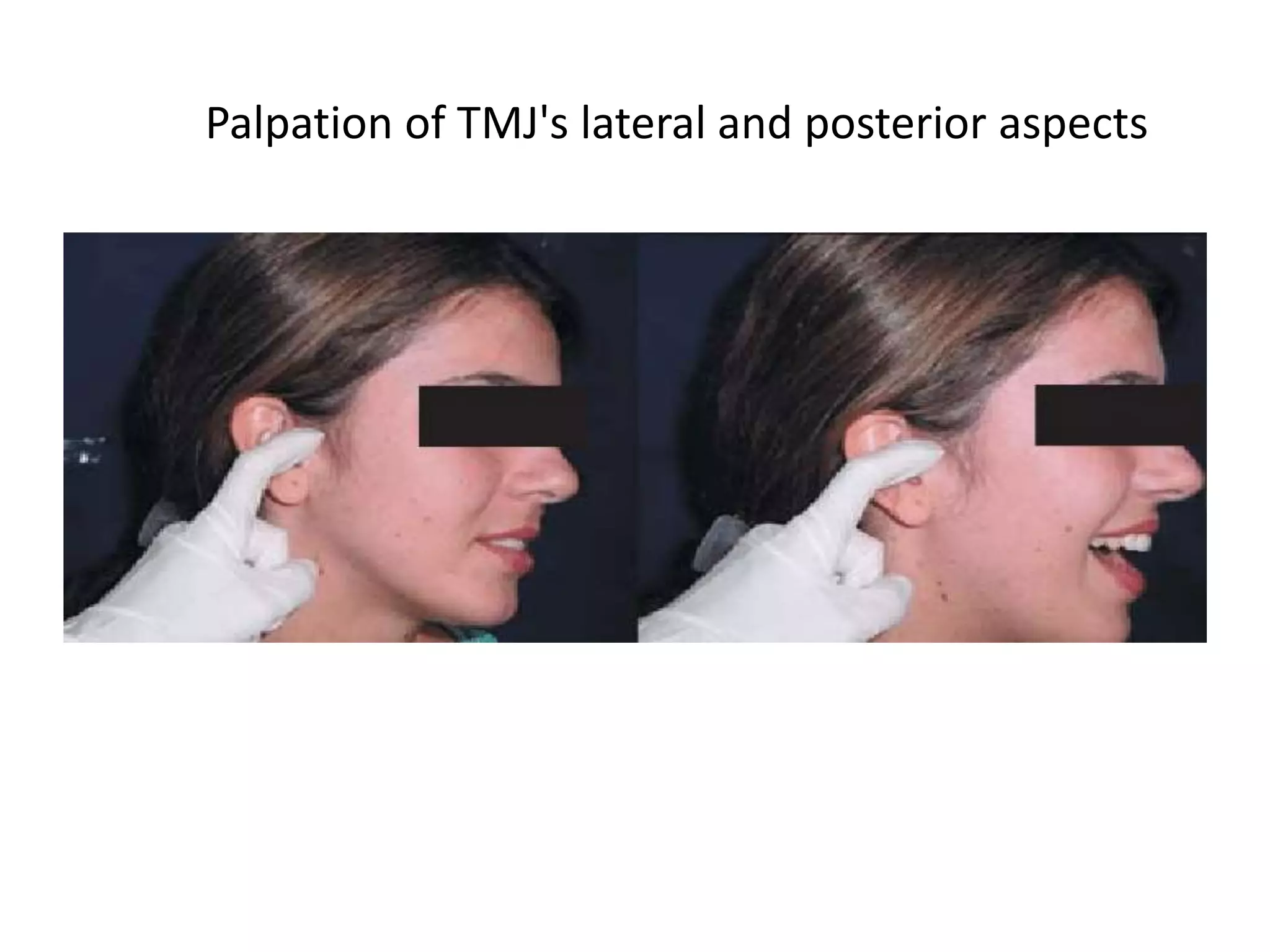Myofascial pain dysfunction (mpd) | PPTX