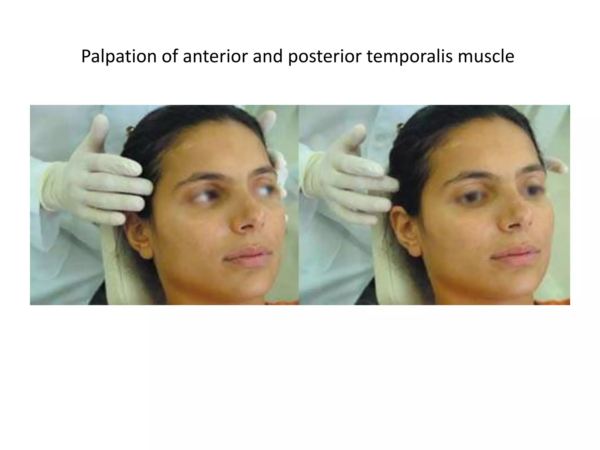 Myofascial pain dysfunction (mpd) | PPTX