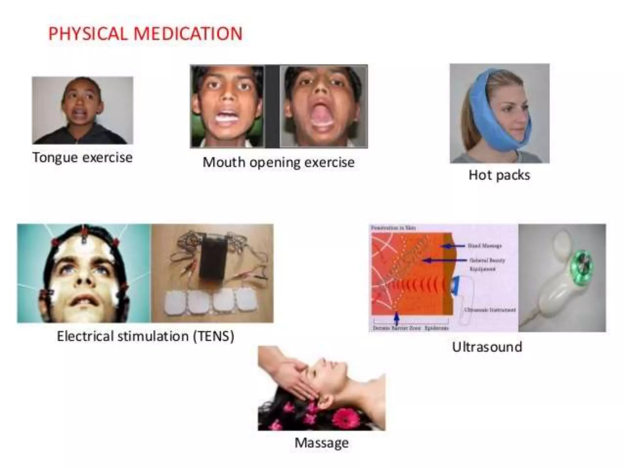 Myofascial pain dysfunction (mpd) | PPTX | Dental Health | Diseases and ...