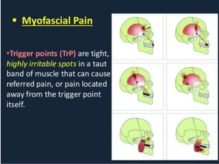 Myofascial pain dysfunction (mpd) | PPTX