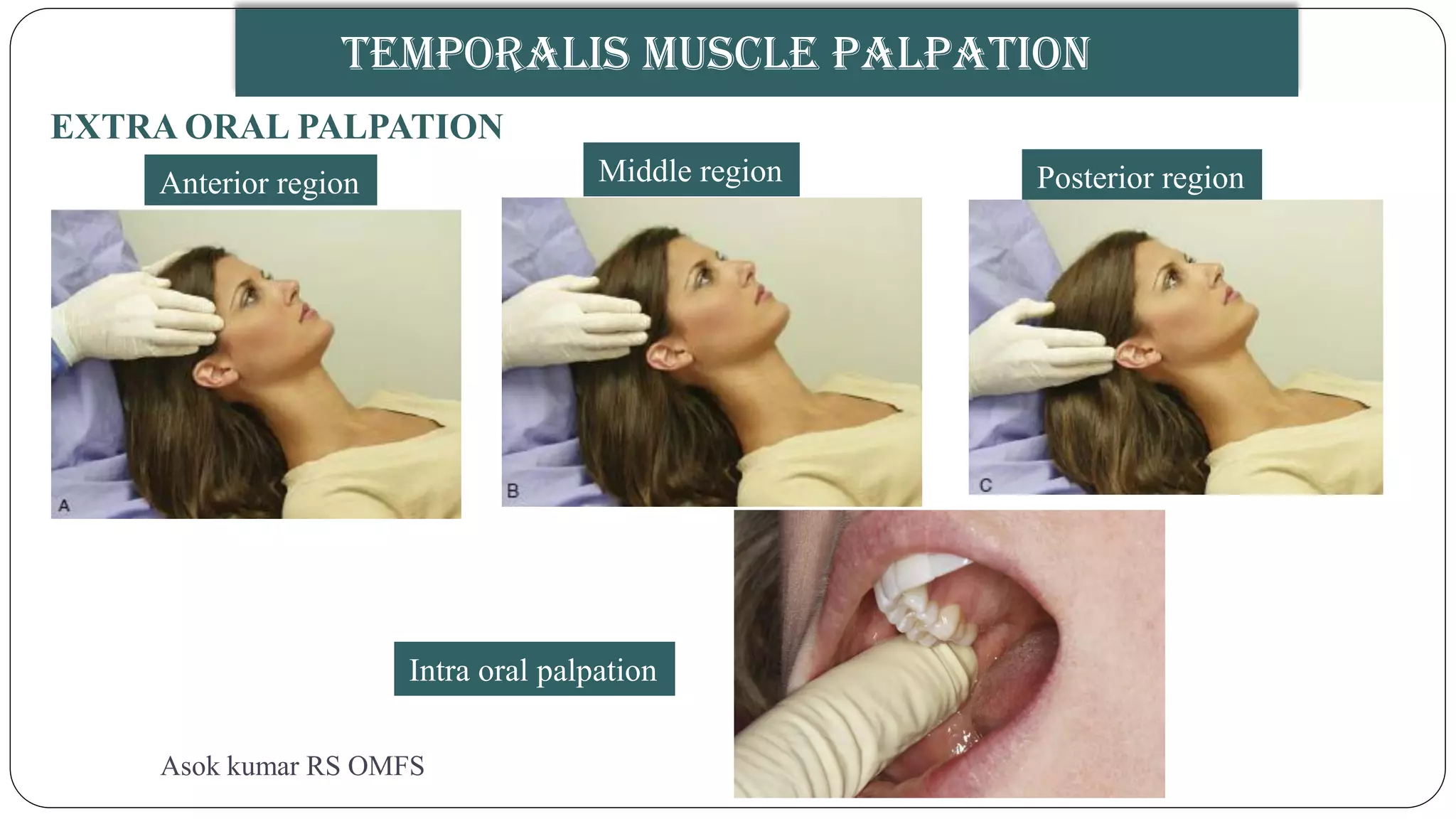 Myofascial pain dysfunction syndrome | PDF