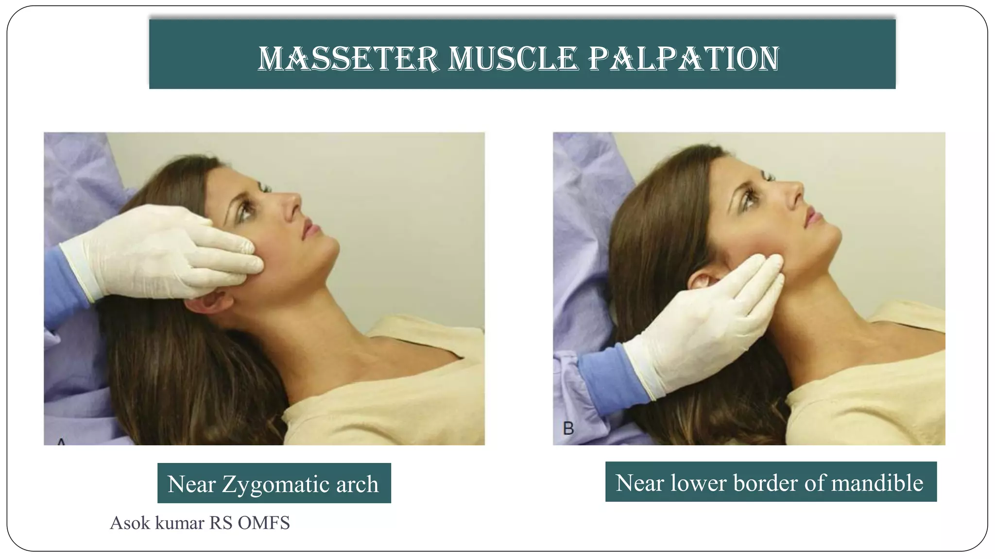 Myofascial pain dysfunction syndrome | PDF