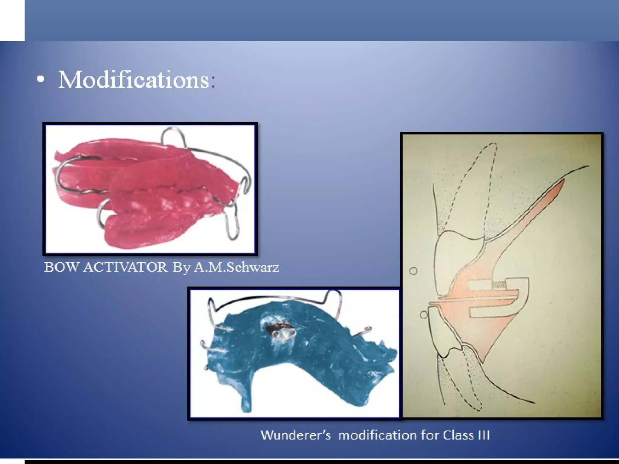 Myofunctional Appliances in orthodontics | PPT