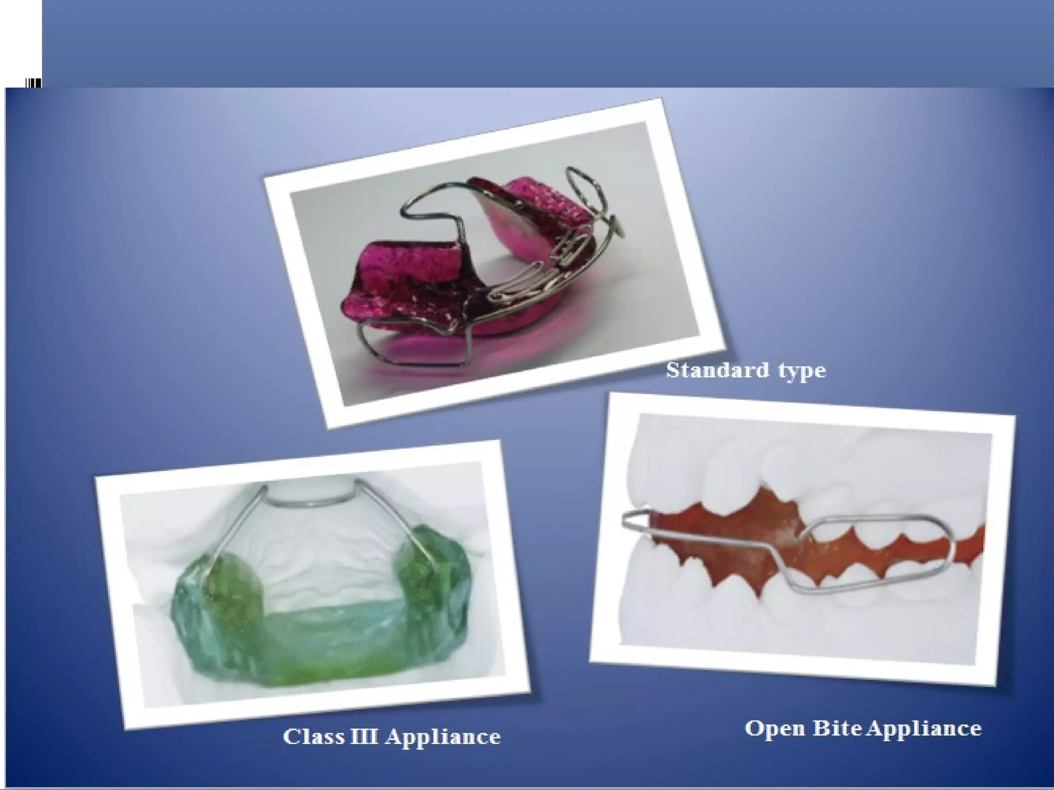 Myofunctional Appliances in orthodontics | PPT