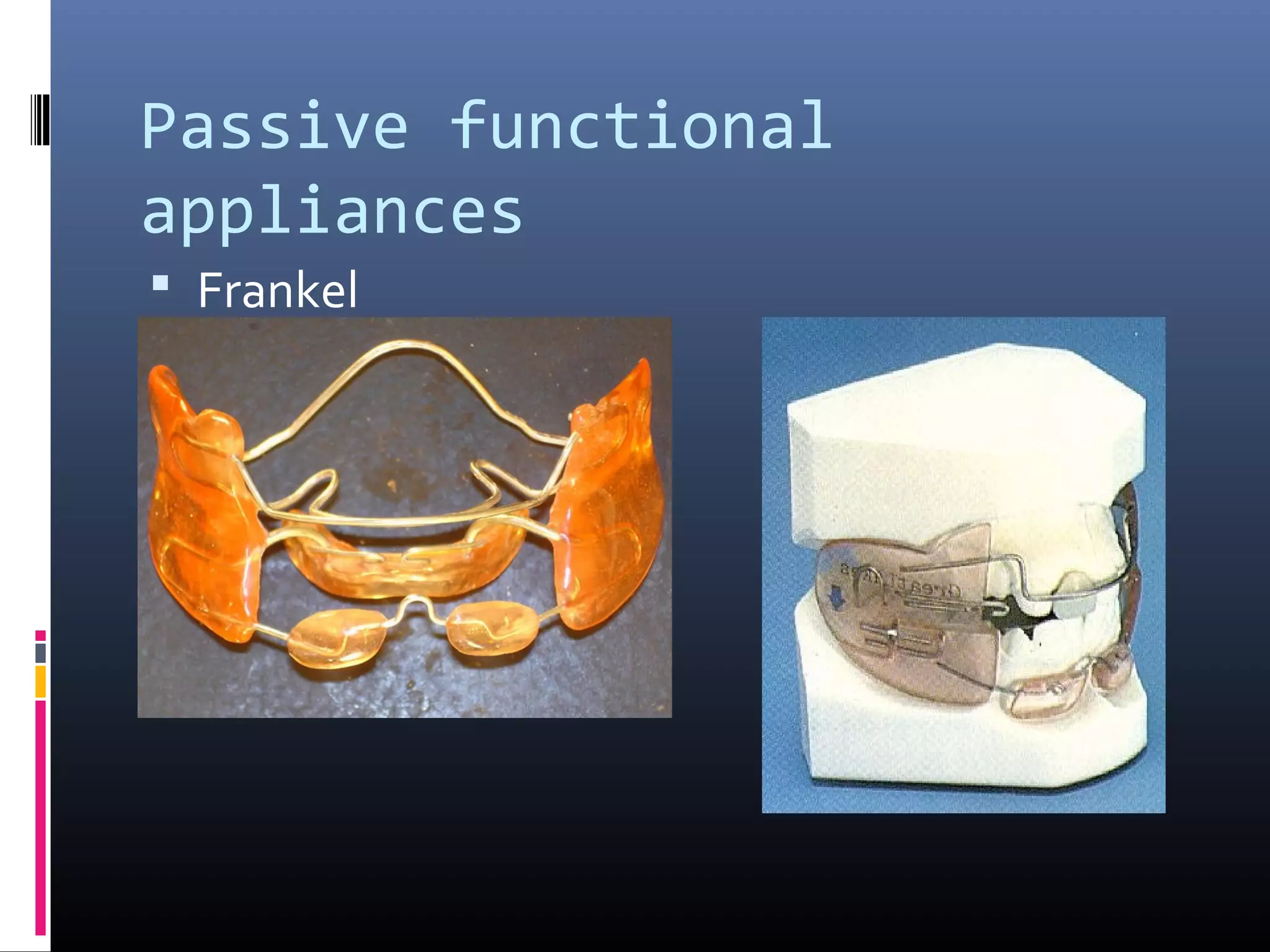 Myofunctional Appliances in orthodontics | PPT