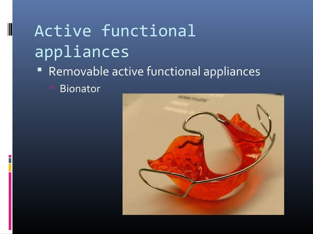 Myofunctional Appliances in orthodontics | PPT | Oral care | Personal Care
