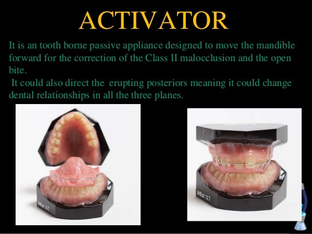 Myofunctional appliances