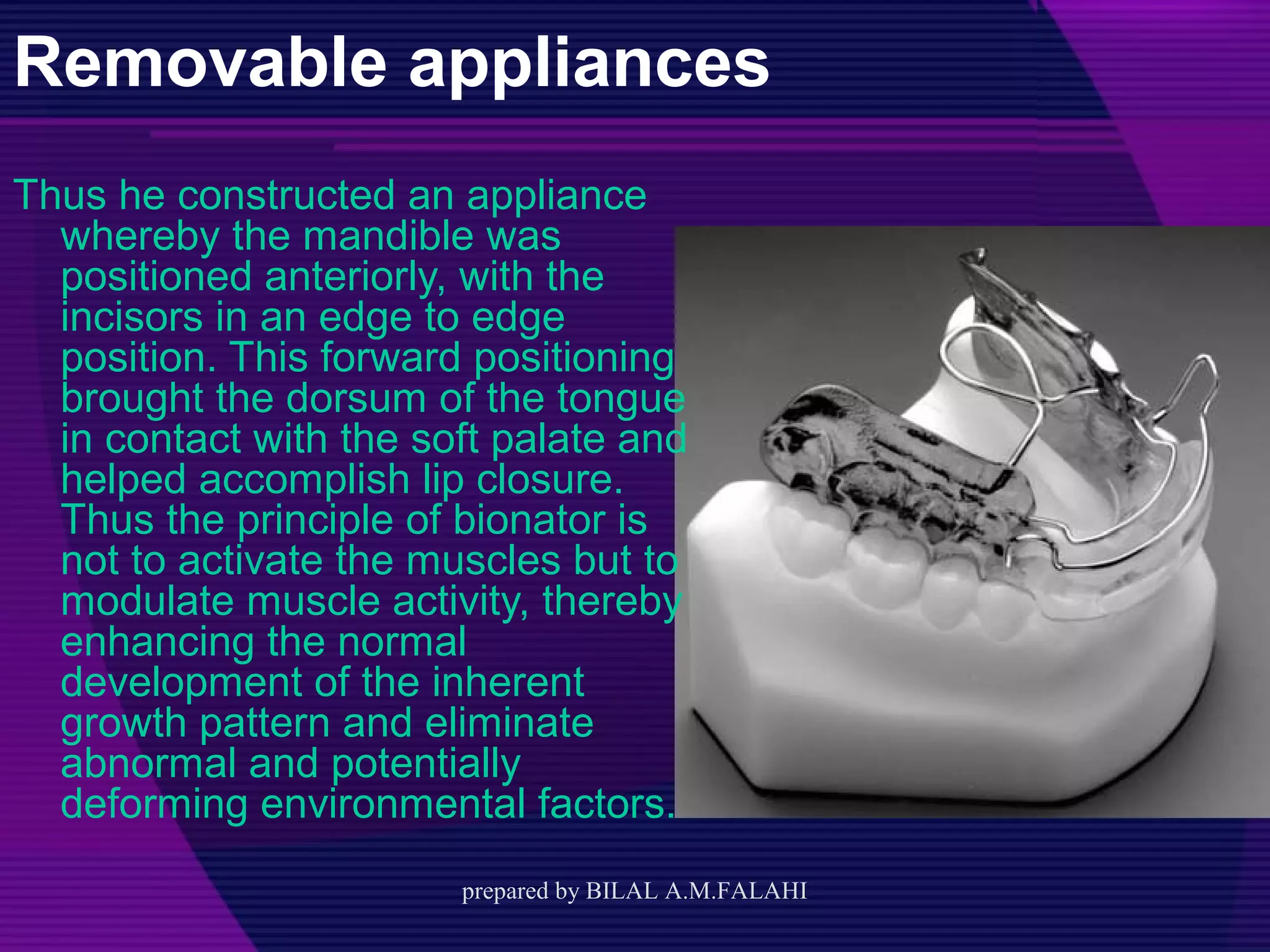 Myofunctional appliances in orthodontic | PPT