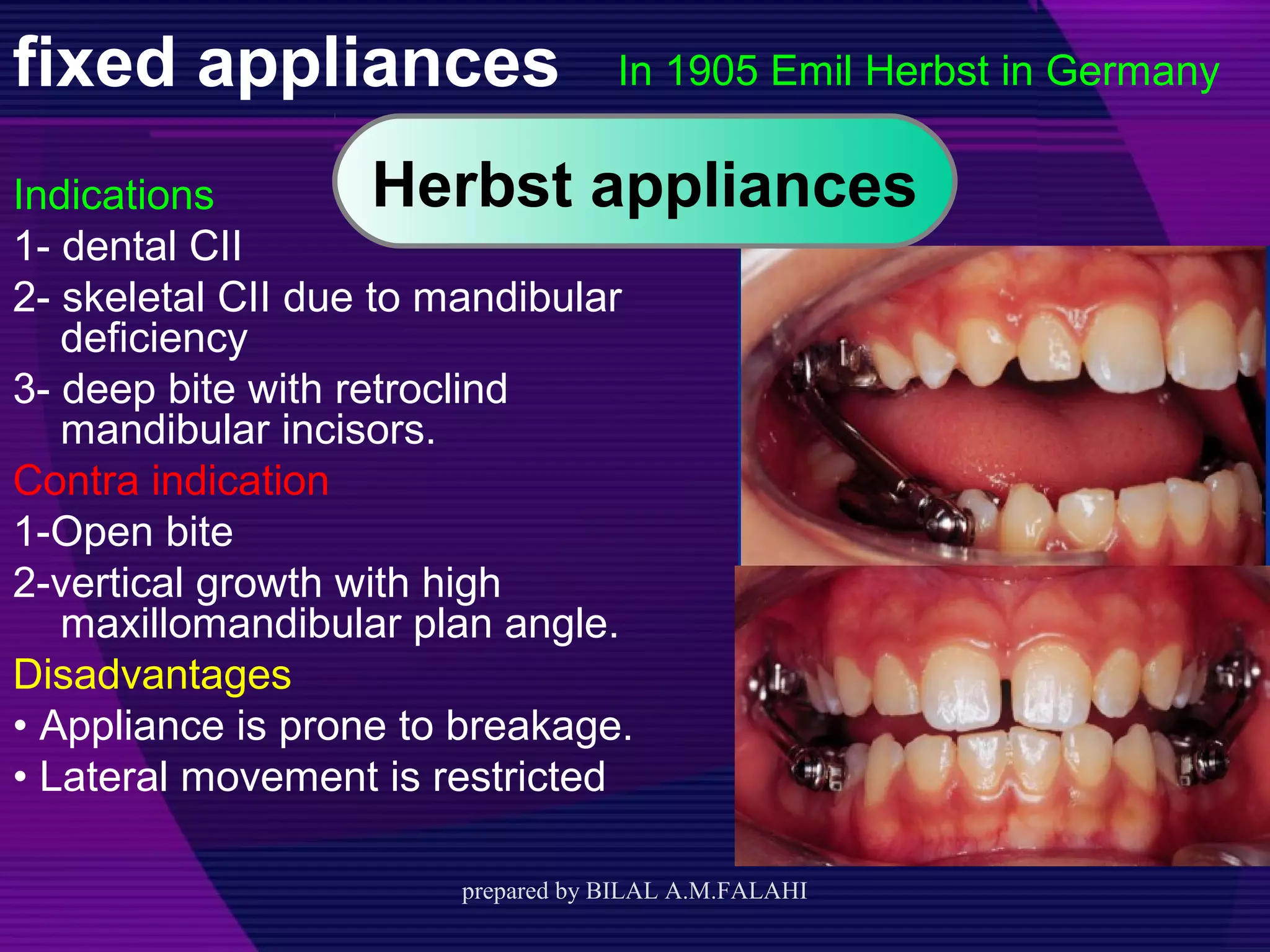 Myofunctional appliances in orthodontic | PPT