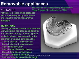Myofunctional appliances in orthodontic | PPT