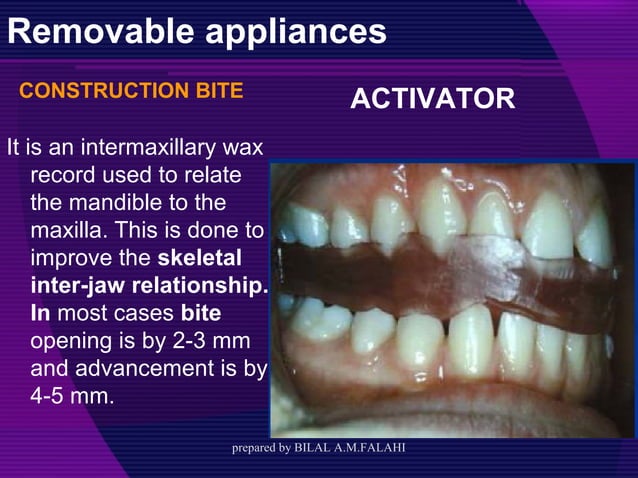 Myofunctional appliances in orthodontic | PPT