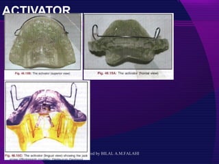 Myofunctional appliances in orthodontic | PPT