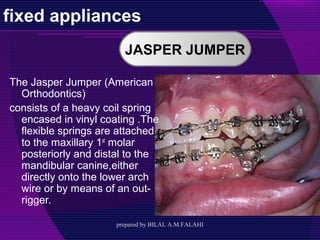 Myofunctional appliances in orthodontic | PPT