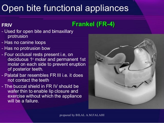 Myofunctional appliances in orthodontic