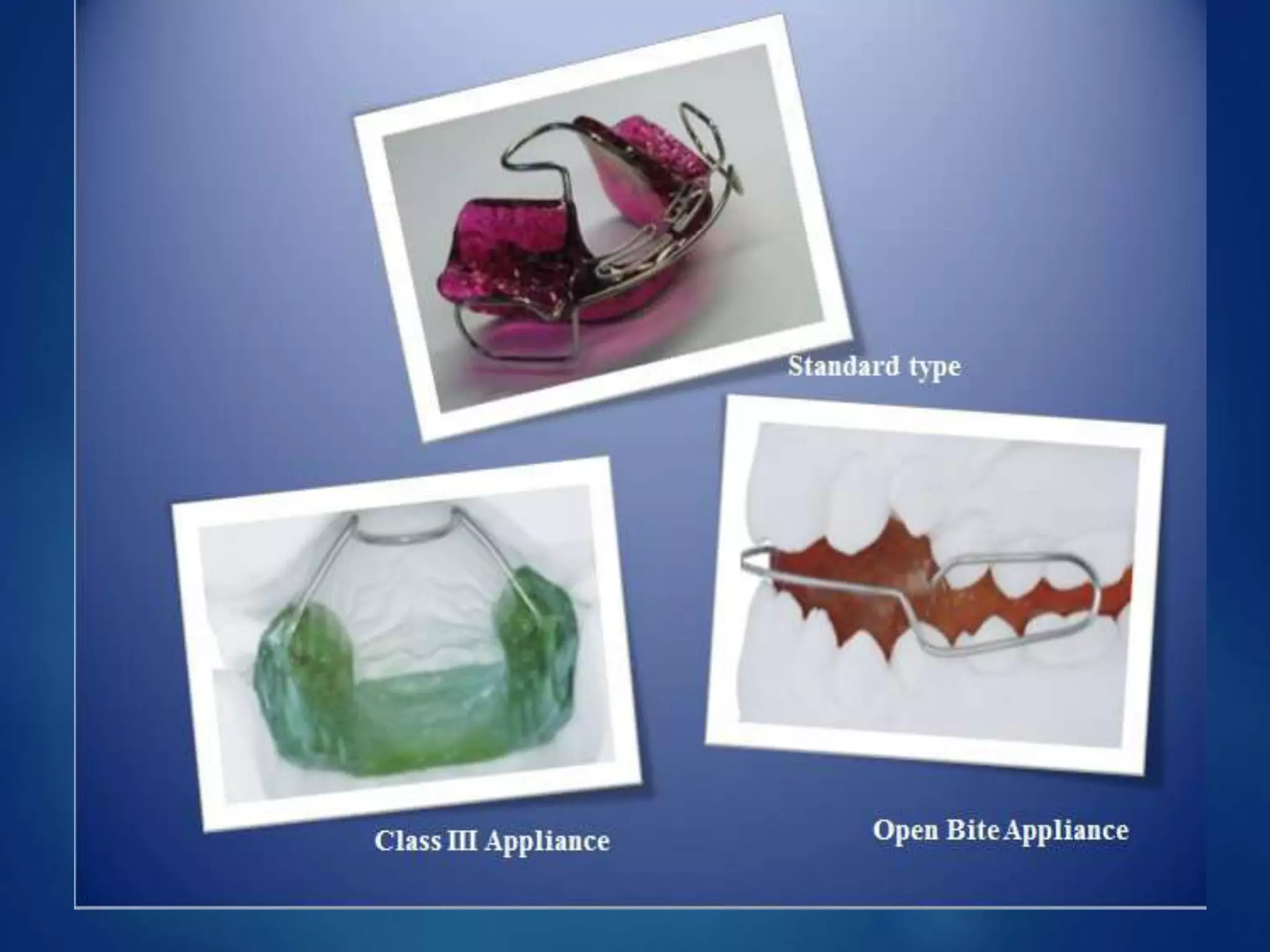 Myofunctional appliances | PPTX
